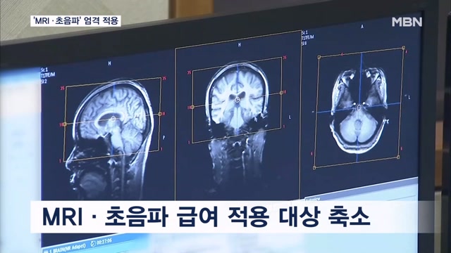 '문케어 개편' 꼭 필요한 검사에만 'MRI·초음파' 급여화